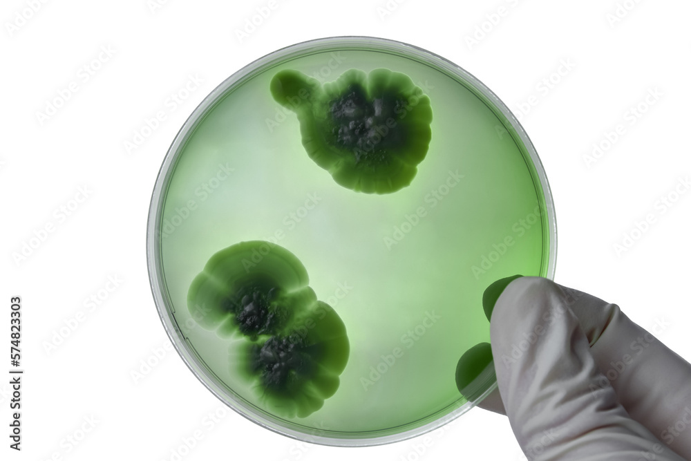 Hand with Petri dish or culture media with bacteria on white background ...