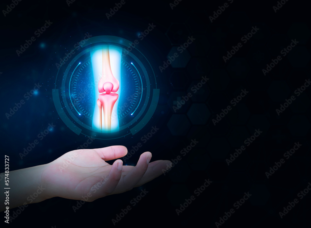 Joint pain, arthritis and tendon problems. human knees with ...