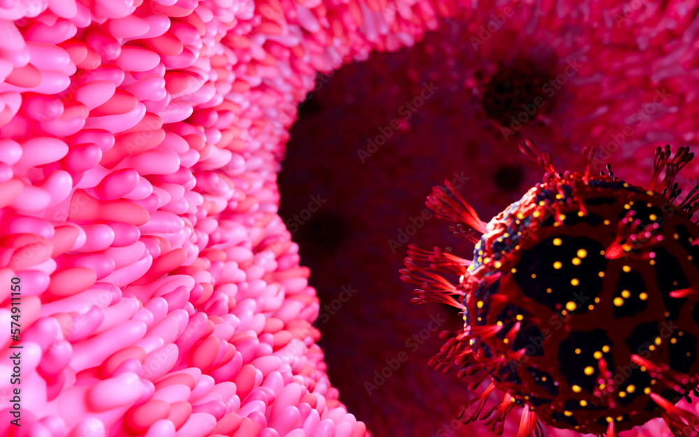 Small intestinal viral model. gastrointestinal disease caused by virus ...