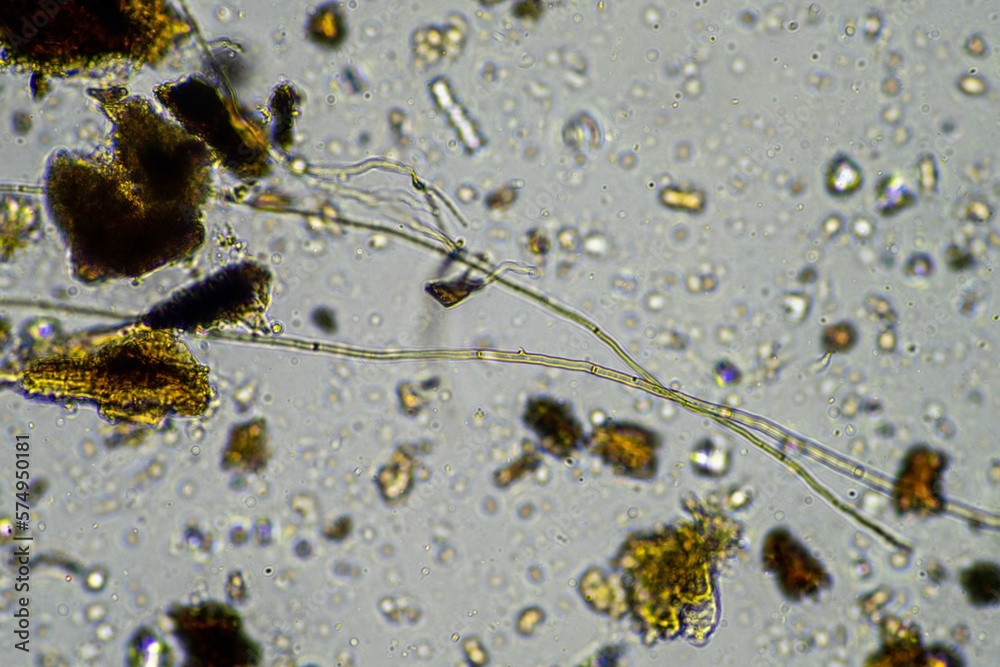 soil microorganisms in a soil sample, soil fungus and bacteria on a ...