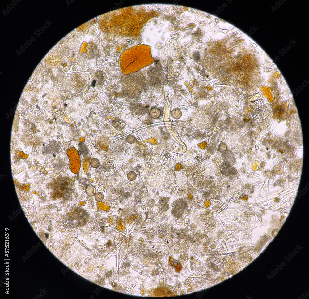 hymenolepis diminuta egg human parasite in stool examination. Stock ...