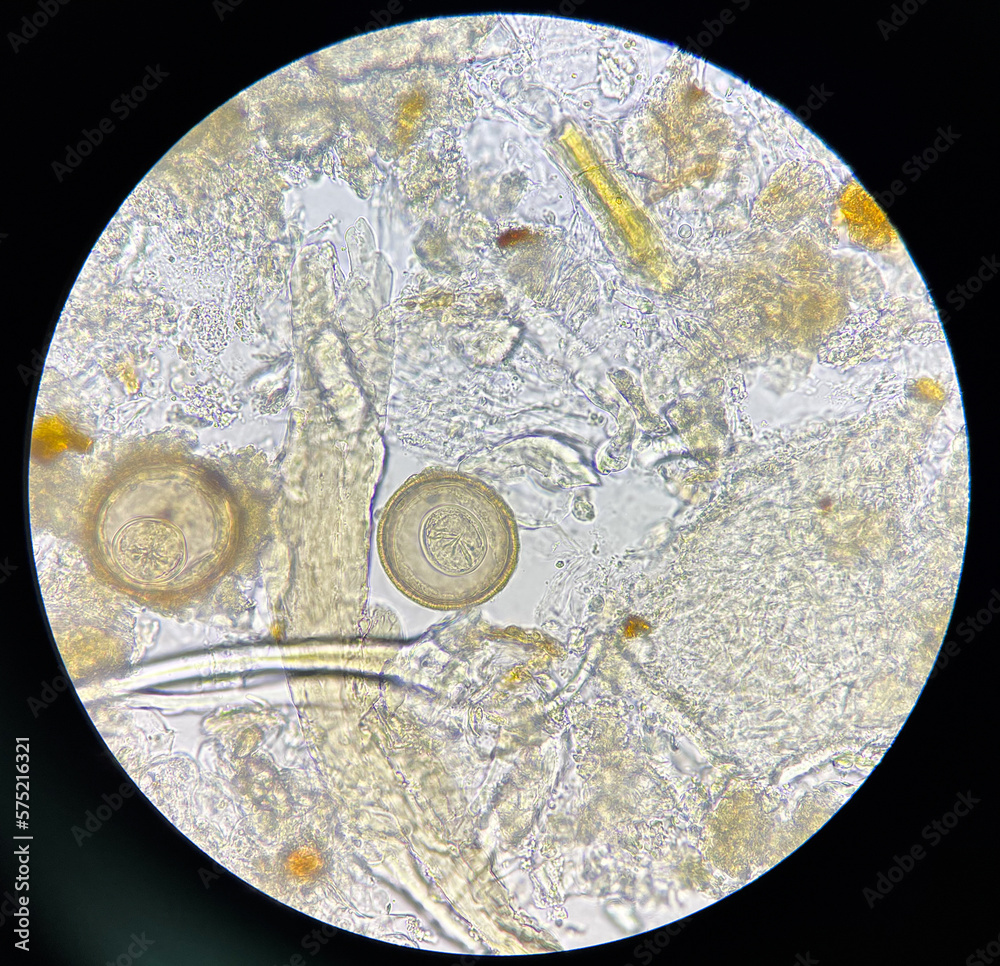 hymenolepis diminuta egg human parasite in stool examination. Stock ...