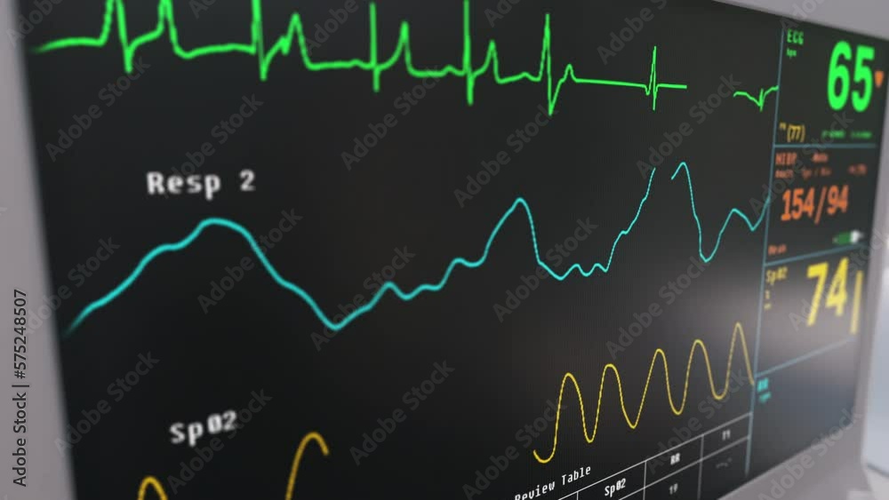 Monitoring heart rate of the emergency patient at the hospital ...