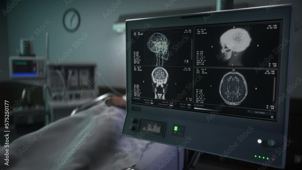 Hospital scanner examining the head of the emergency patient. Medical ...