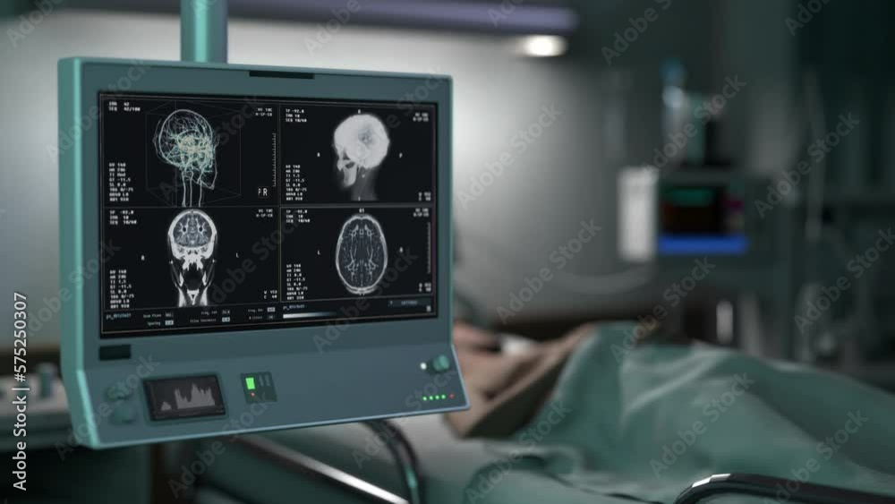 Imaging the damaged brain to identify the disease. Patient imaging ...