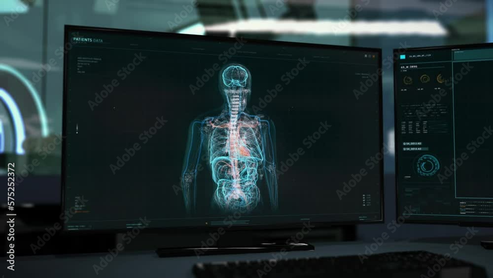 Analysis Of Skeleton In Futuristic Anatomical System For Medical ...
