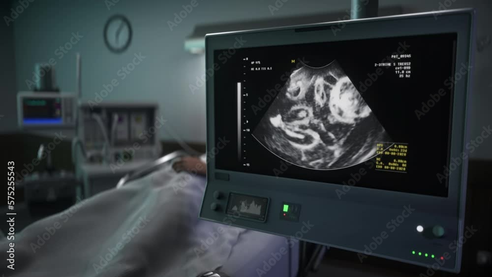 X-ray screening scanner examining the child in the belly. X-ray ...