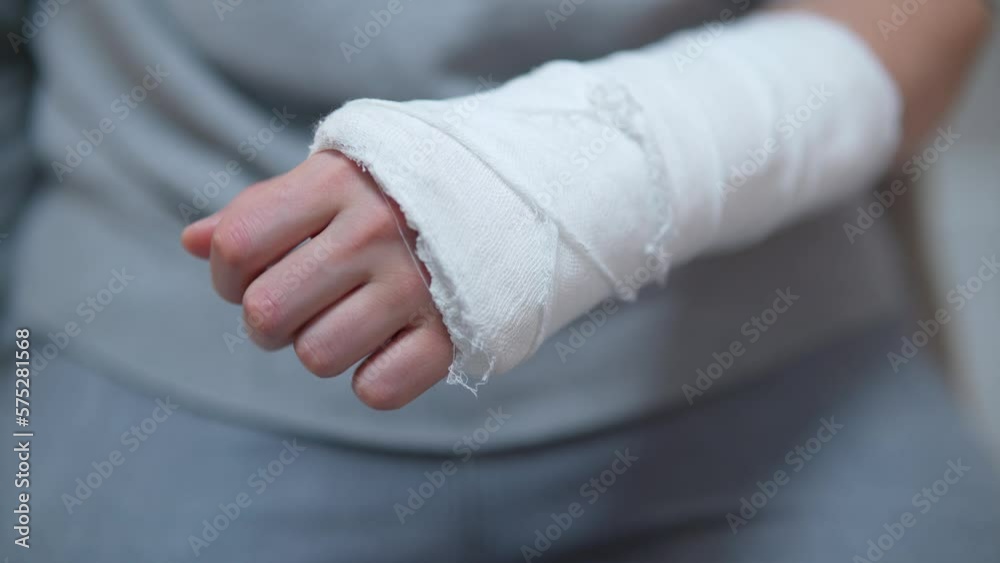 Man with plaster cast on arm. The difficulty of self-movement of the ...