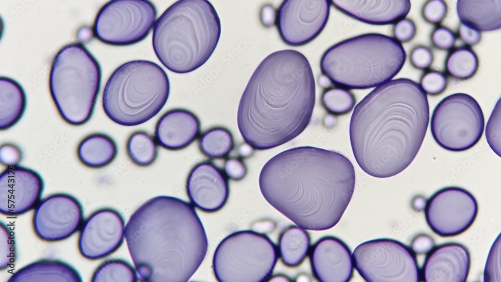 Starch granules of potato. Stained by lugol iodine. 400x magnification ...