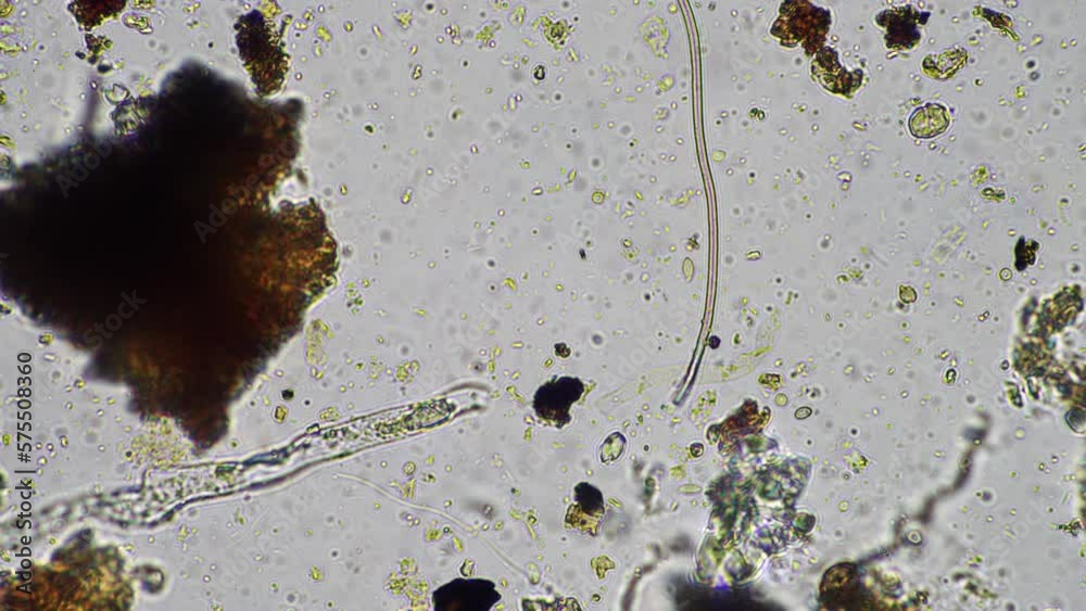soil microorganisms including nematode, microarthropods, micro ...