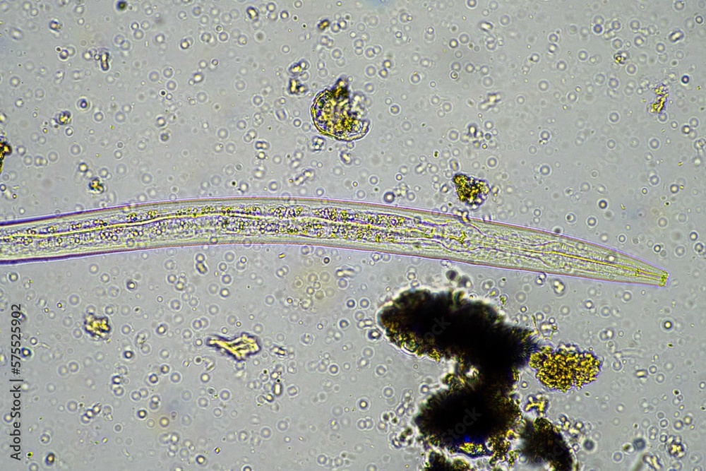 soil parasite in a sample under the microscope on a farm in Australia ...