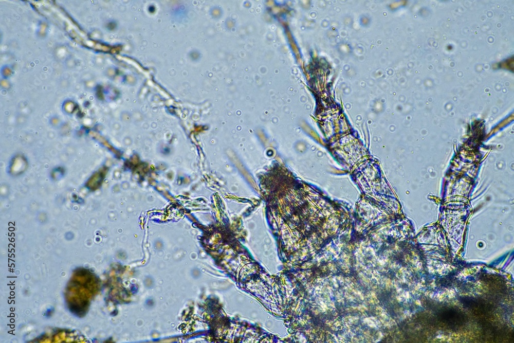 soil parasite in a sample under the microscope on a farm in Australia ...