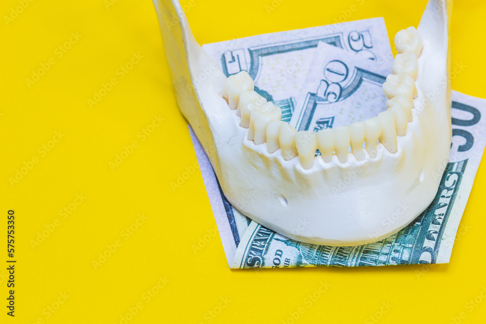 jaw of a human with teeth and banknotes of money, lower jaw,banknote of ...