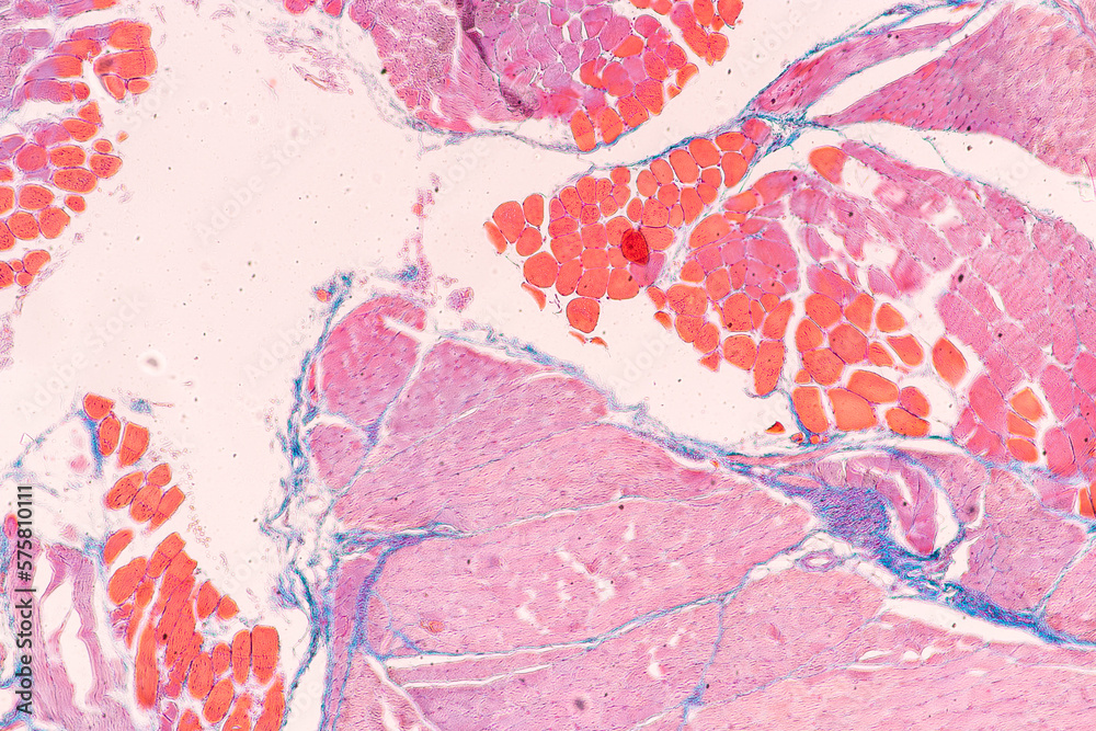Adipose tissue human, Soft palate human, Bone human and Striated ...