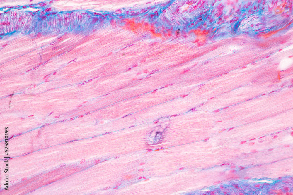 Adipose Tissue Human Soft Palate Human Bone Human And Striated Skeletal Muscle Human Under