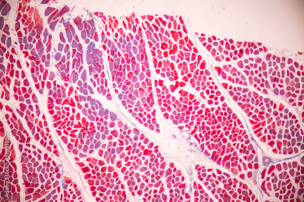 Adipose tissue human, Soft palate human, Bone human and Striated ...