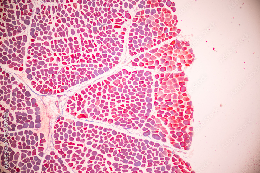 Adipose tissue human, Soft palate human, Bone human and Striated ...