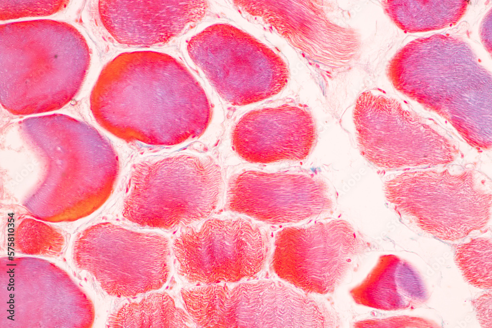 Adipose tissue human, Soft palate human, Bone human and Striated ...