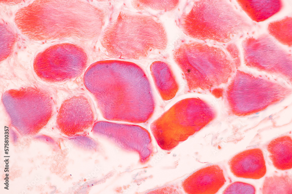Adipose tissue human, Soft palate human, Bone human and Striated ...