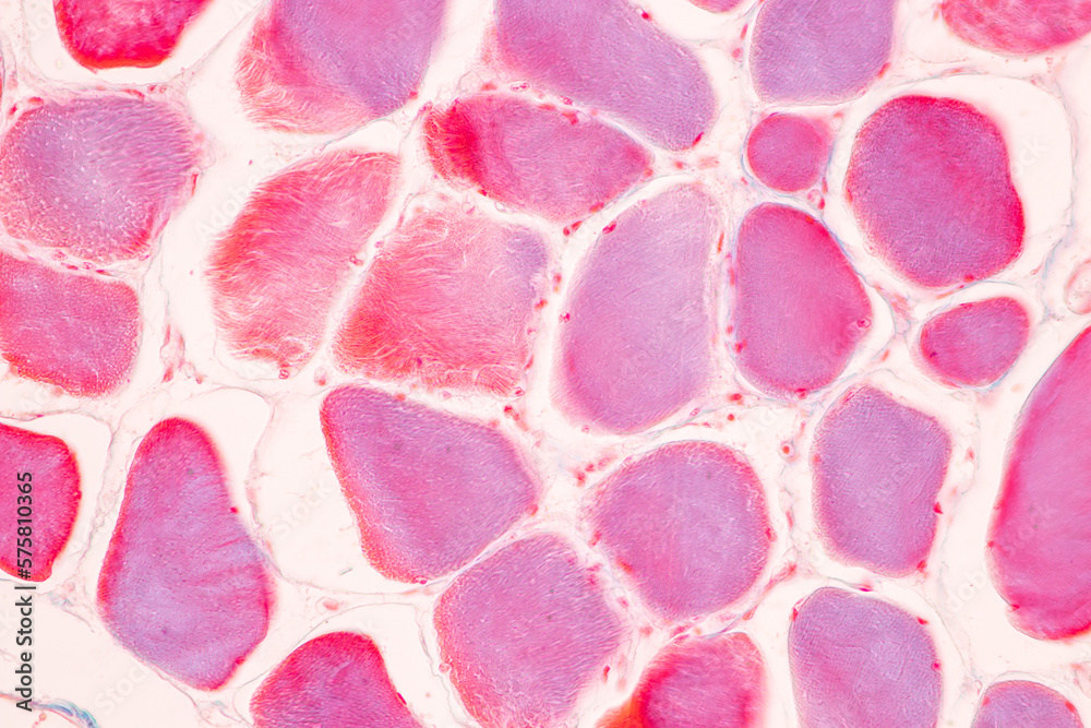 Adipose tissue human, Soft palate human, Bone human and Striated ...