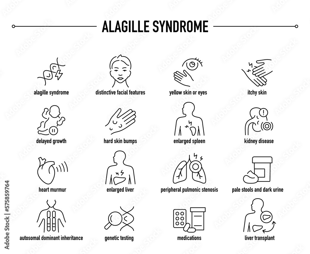 Alagille Syndrome symptoms, diagnostic and treatment vector icon set ...