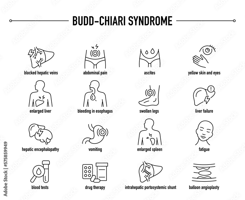 Budd-Chiari Syndrome symptoms, diagnostic and treatment vector icon set ...