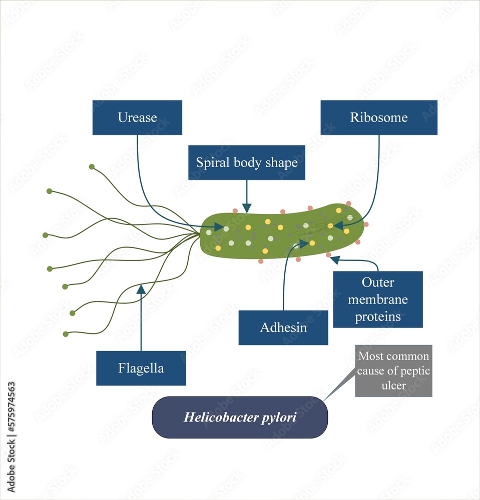 Helicobacter pylori - a gram-negative, microaerophilic, bacterium ...