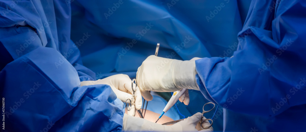 Panorama banner inside operating room.Doctor and team of nurse doing ...