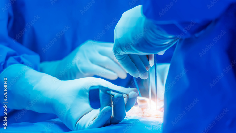 Panorama banner inside operating room.Doctor and team of nurse doing ...