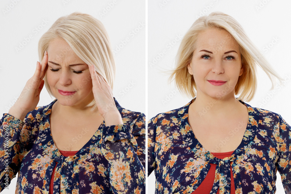 Before after Women Hormonal Headaches. Middle aged woman with Menopause ...
