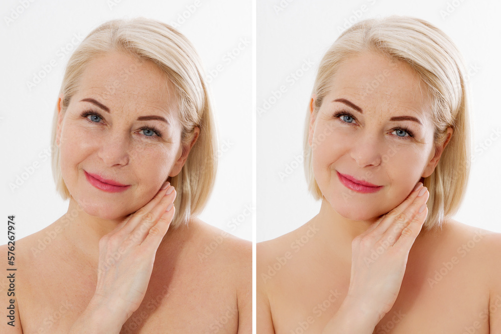 Closeup before after Beauty middle age woman face portrait. Before ...