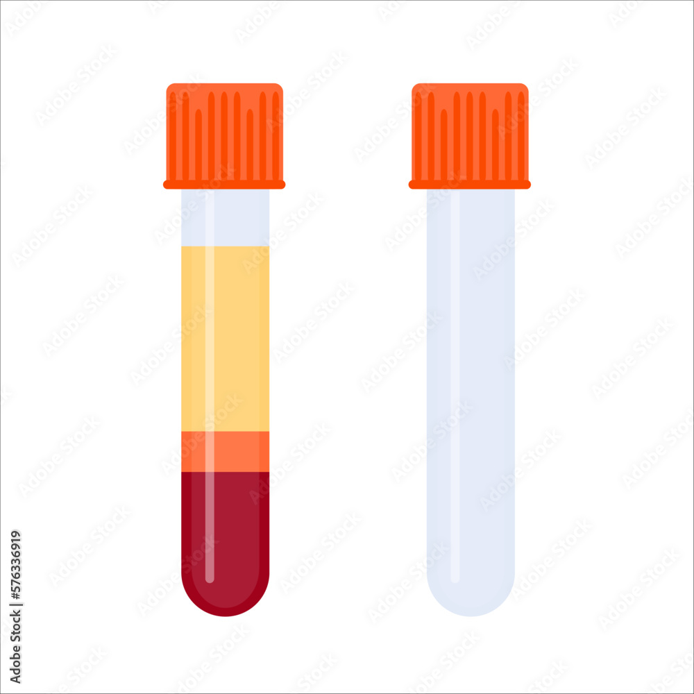 Laboratory tube rack with PRP blood collection tubings after separation ...