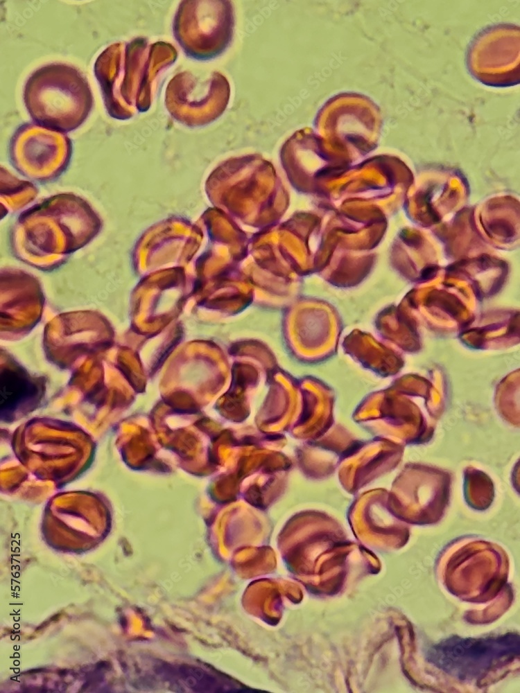 Red blood cells inside vein - hematoxylin and eosin stain Stock Photo ...