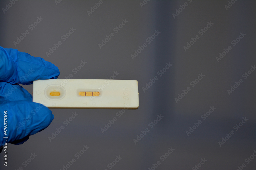 Positive urine pregnancy test, Human chorionic gonadotropin (hCG), a ...