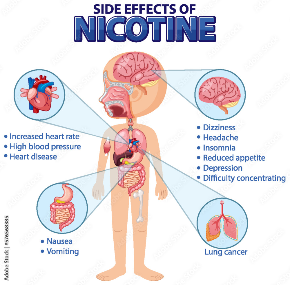 Human Anatomy Diagram Cartoon Style Of Nicotine Side Effects Stock Human Anatomy Diagram Cartoon Style Of Nicotine Side Effects Stock