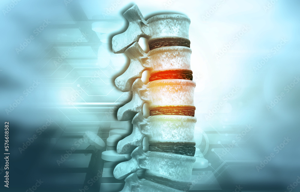 Spine anatomy, disk bulge, back pain concept. 3d illustration.. Stock ...