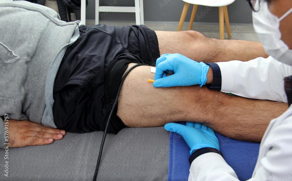 Electromyography EMG and Somatosensory Evoked Potential PEV of lower ...