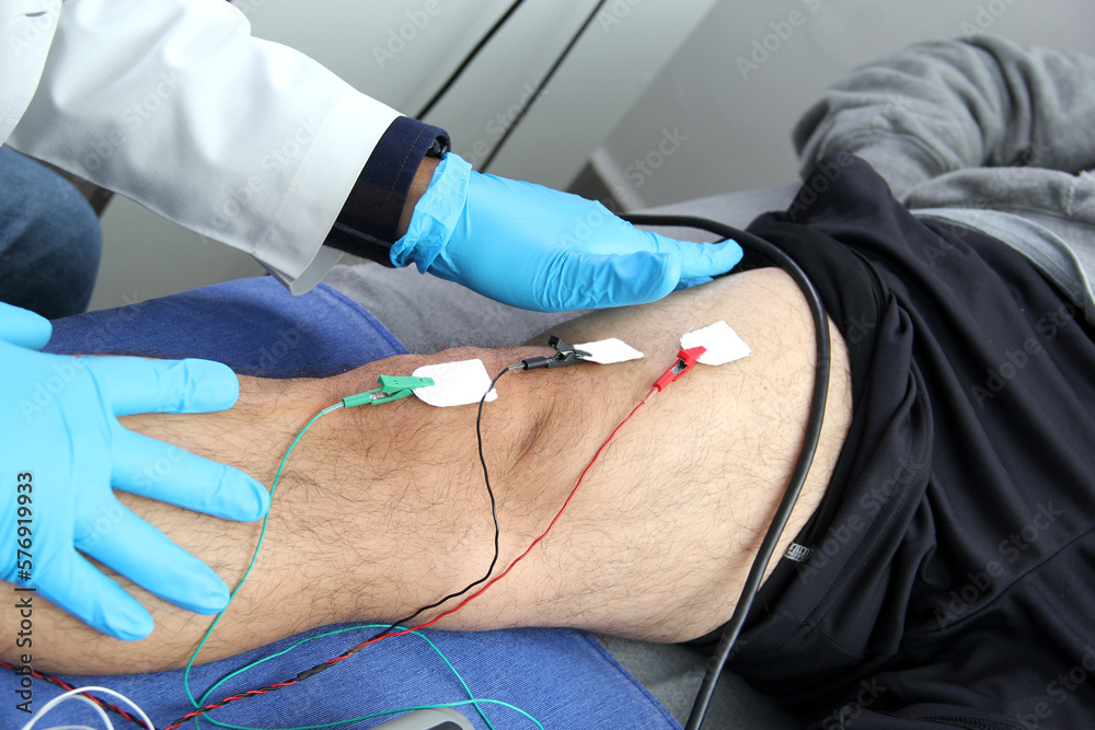 Electromyography EMG and Somatosensory Evoked Potential PEV of lower ...