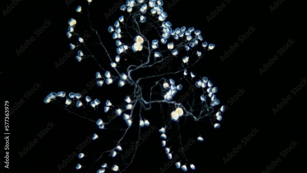 Infusoria Ciliophora Peritrichia under microscope, order Sessilida ...