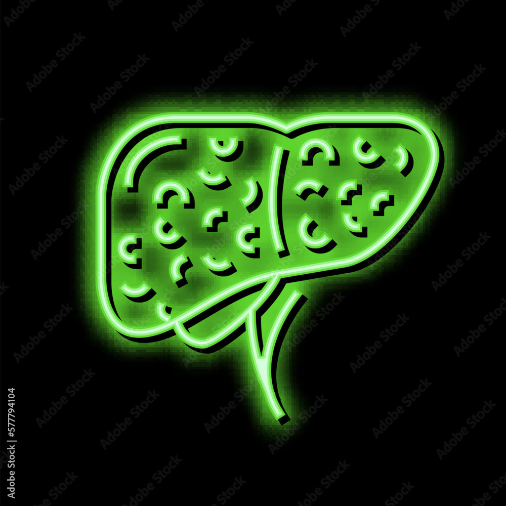 liver cirrhosis disease neon glow icon illustration Stock Vector ...
