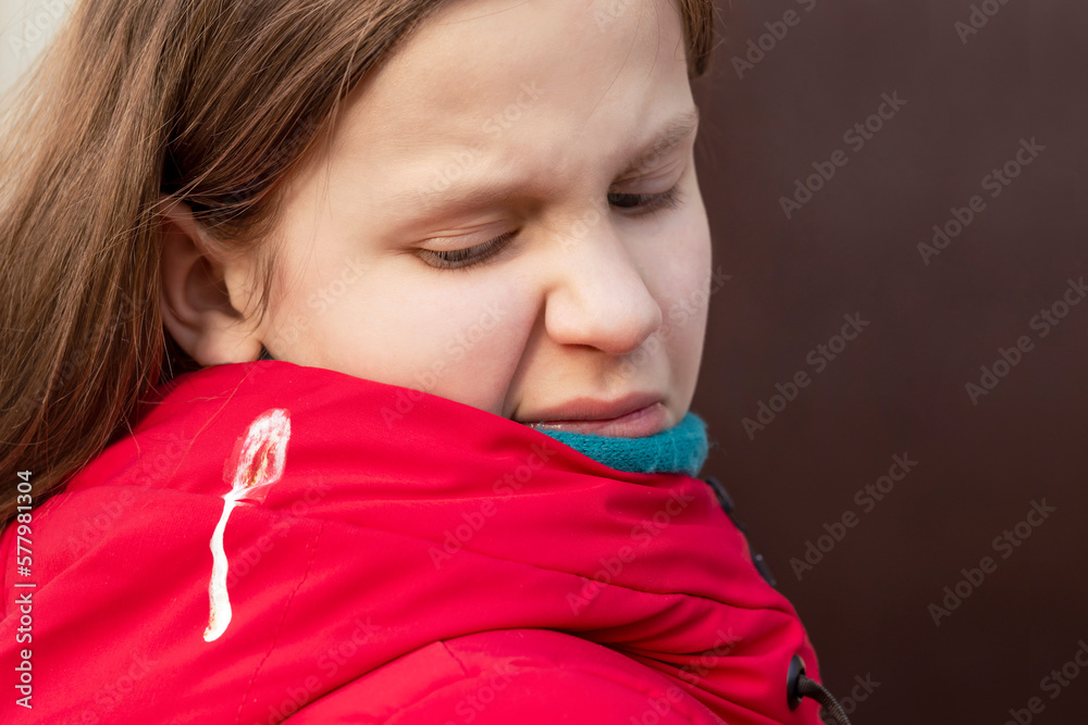 Bird Poop or Raven Droppings on Girl jacket shoulder on Dark Background ...