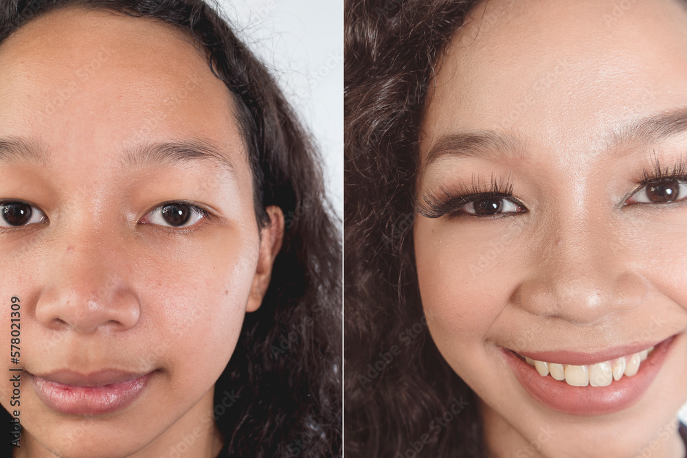 A before and after result of a young asian fashion model. Split face ...