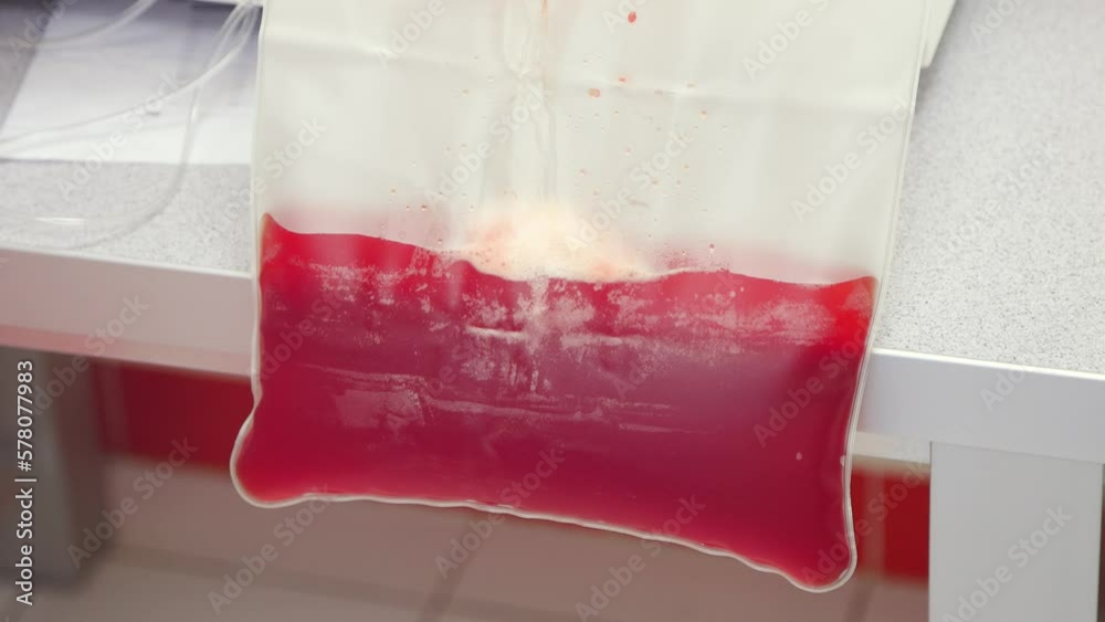 Video „Close view of the red blood cells in container of blood stored ...