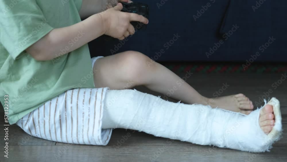 close-up of a boy with a splint on his leg plays with a joystick in the ...