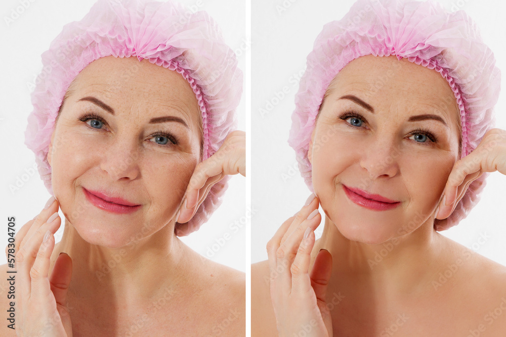 Closeup before after Beauty middle age woman face portrait. Before ...