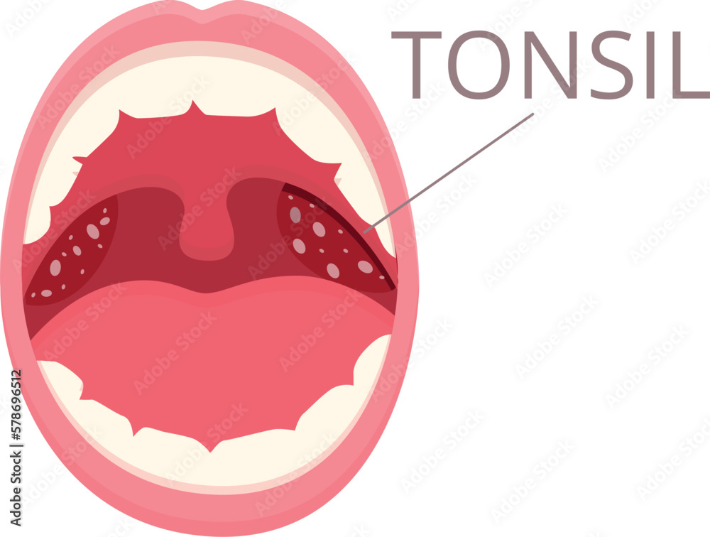Mouth tonsillitis icon cartoon vector. Bacterial hygiene. Cancer ...