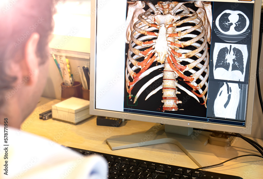 The doctor looks at the chest X-ray. CT or MRI scans on the computer ...