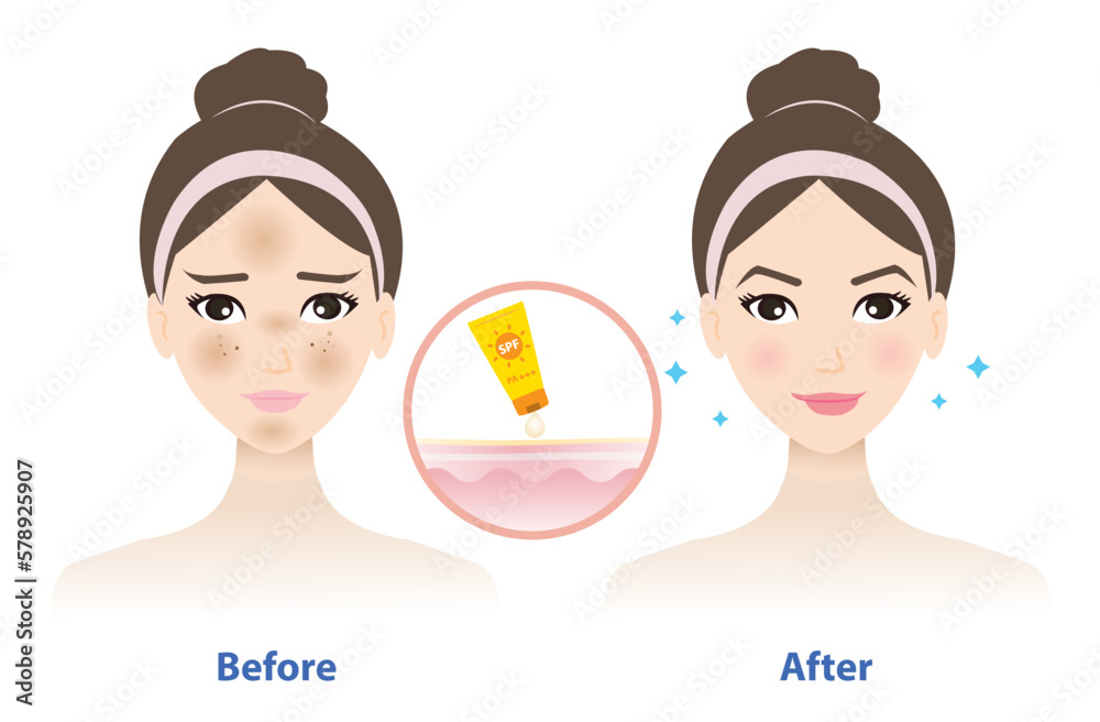 Before and after get used sunscreen vector isolated on white background ...