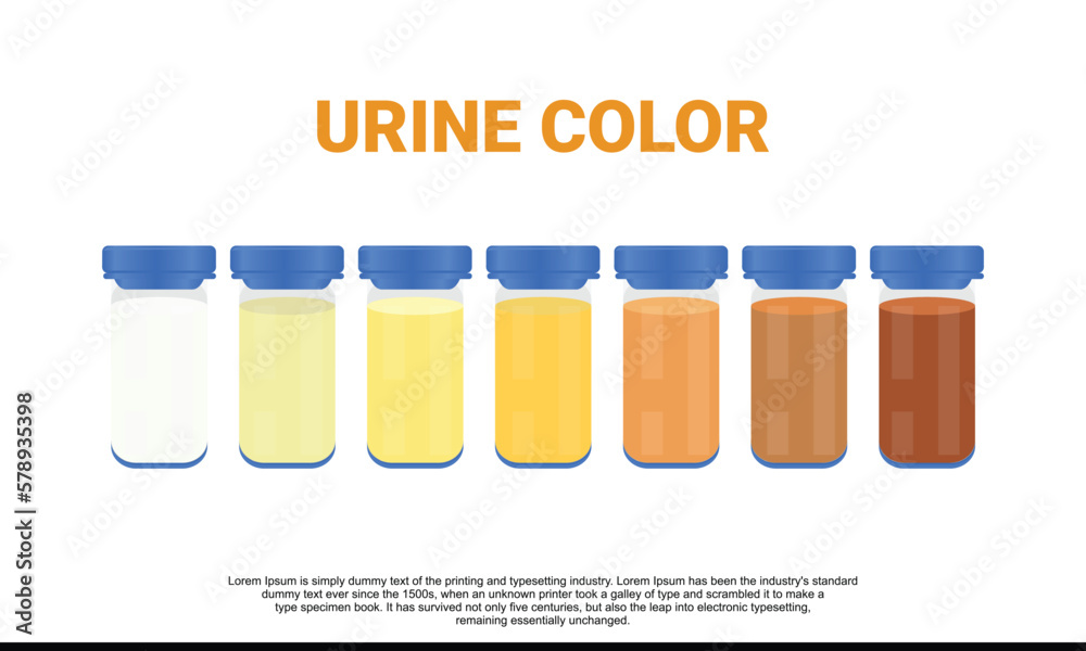 Illustration of urine color chart Stock Vector | Adobe Stock
