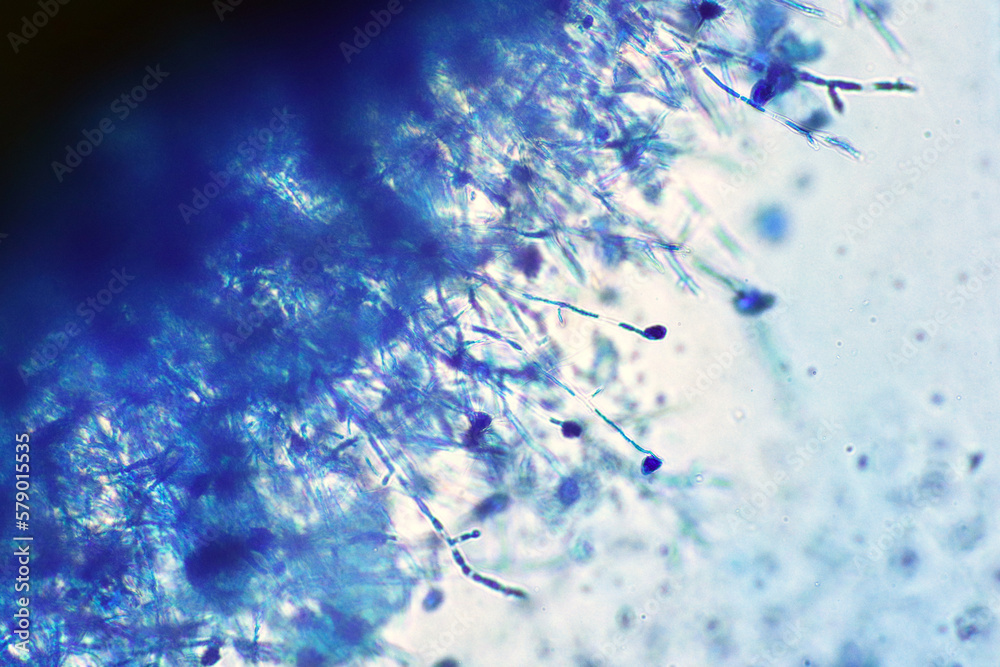 Microscope of black fungus spore strain with Lactophenol cotton blue ...